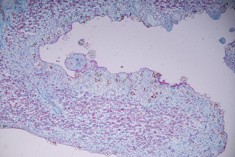Host Cells with Spores Mold are Inside Wood Under the Microscope. Stock ...