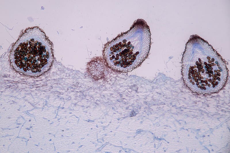 Host Cells with Spores Mold are Inside Wood Under the Microscope Stock ...
