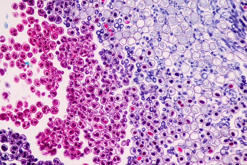 Host Cells with Spores Mold are Inside Wood Under the Microscope ...