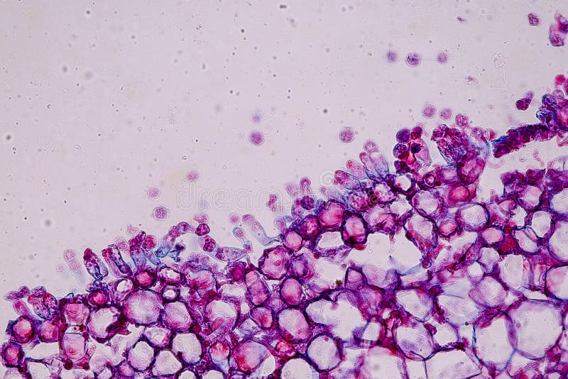 Host Cells with Spores Mold are Inside Wood Under the Microscope Stock ...