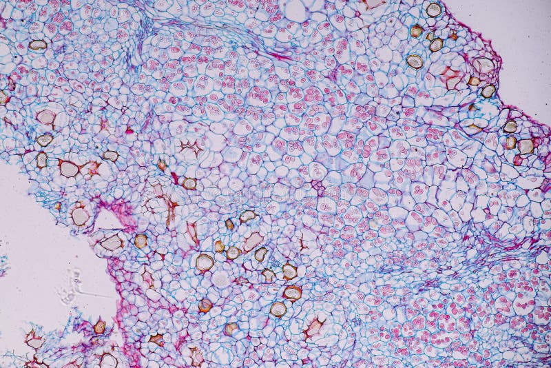 Host Cells with Spores Mold are Inside Wood Under the Microscope. Stock ...
