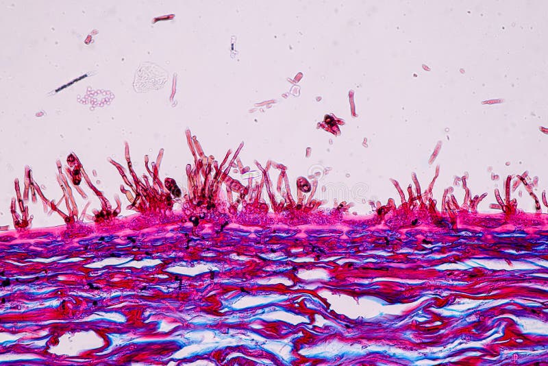 Host Cells with Spores Mold are Inside Wood Under the Microscope. Stock ...