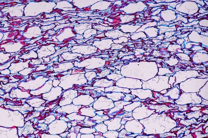 Host Cells with Spores Mold are Inside Wood Under the Microscope. Stock ...