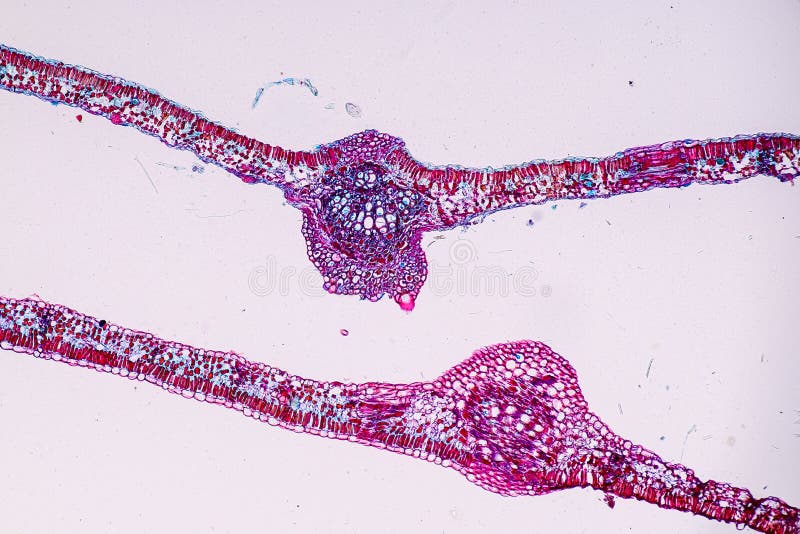 Host Cells with Spores Mold are Inside Wood Under the Microscope. Stock ...