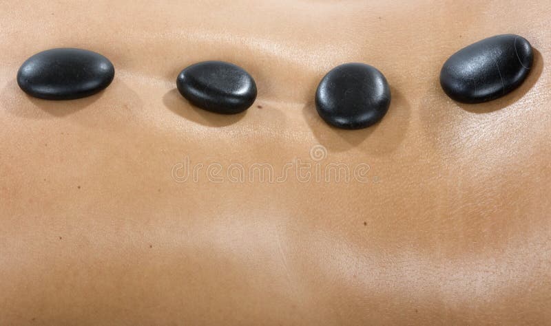 Hot-stone Treatment Picture. Image: 6102655