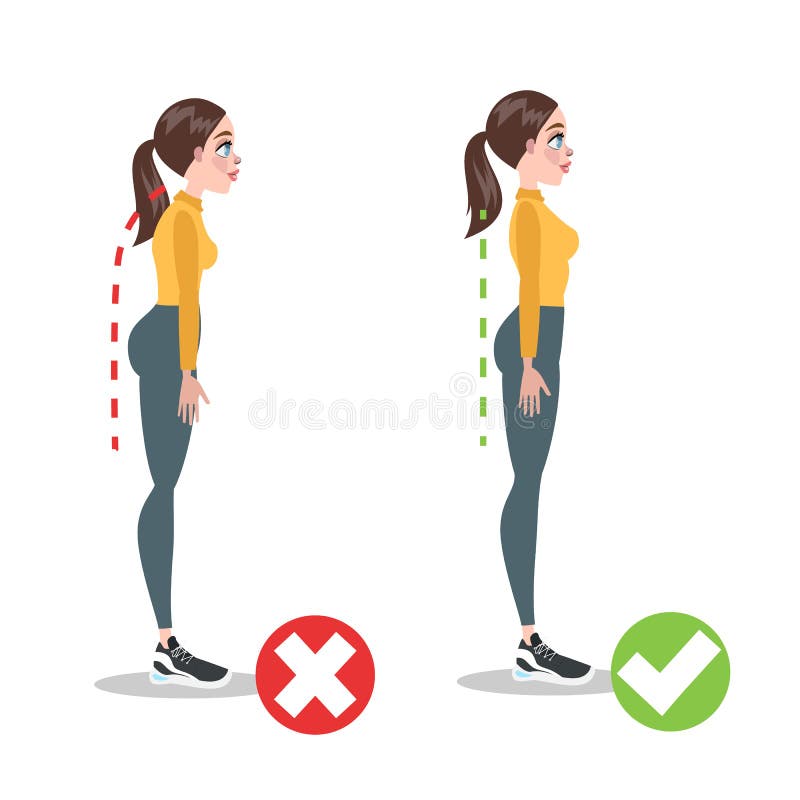 How To Correct Posture Infographic. Incorrect Pose Stock Vector ...
