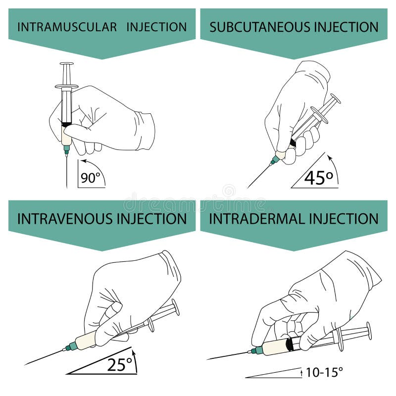 Injections Diagram Stock Illustrations – 68 Injections Diagram Stock ...