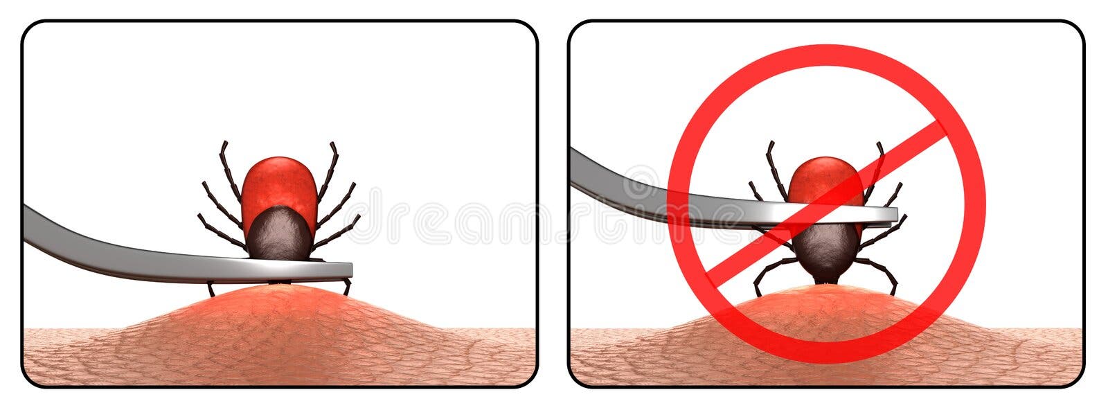 How To Remove Tick Infographics Banner, Flat Vector Illustration on ...