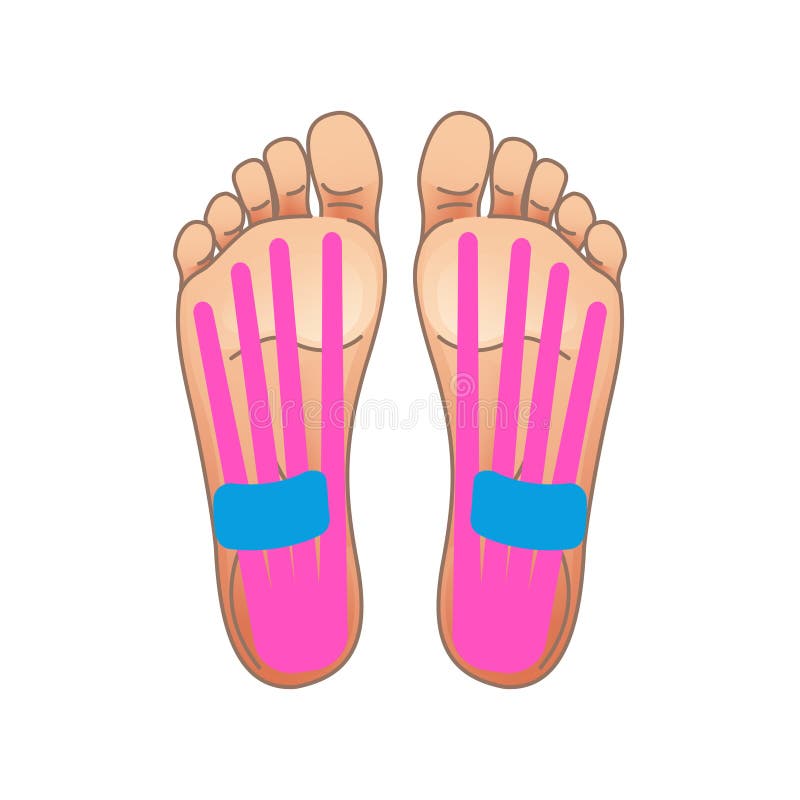 Kinesio Taping Stock Illustrations – 70 Kinesio Taping Stock ... Kinesio Taping Stock Illustrations – 70 Kinesio Taping Stock ...