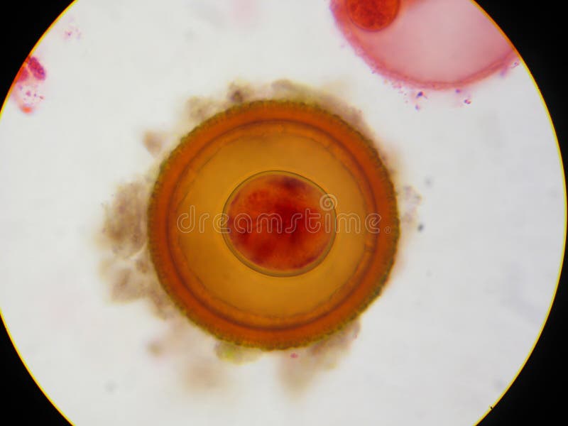 Huevo De La Solitaria (tenia) Imagen de archivo - Imagen de huevo ...