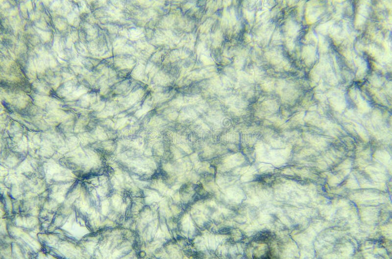 Huid onder de microscoop stock afbeelding. Image of zorg - 28688883