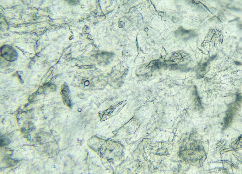 Huid onder de microscoop stock foto. Image of achtergrond - 29133676