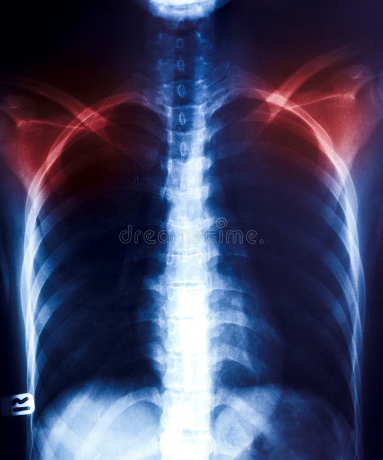 Radiographie humaine photo stock. Image du médecine, tête - 42767758