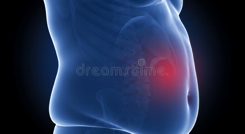 Human Abdomen Pain Illustration Indicating Digestive Problem Anatomy ...