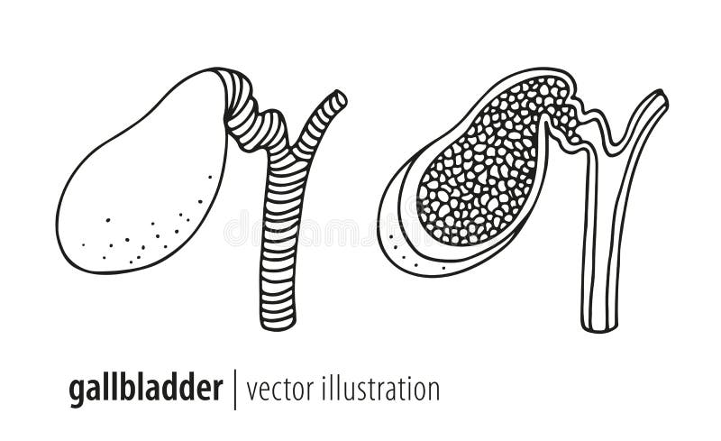 Getdrawings Gallbladder Drawing Gallstones Sketch Coloring Page