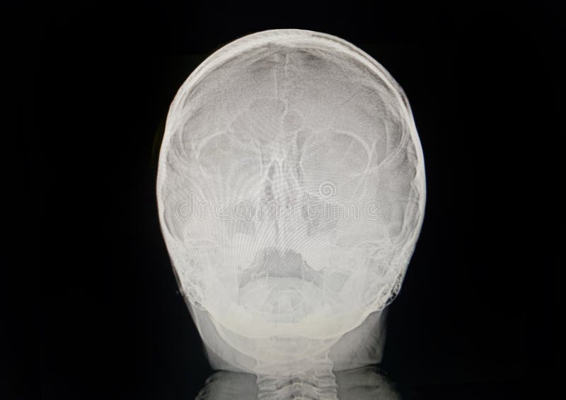 Human anatomy. Head X-ray stock image. Image of biology - 369446733