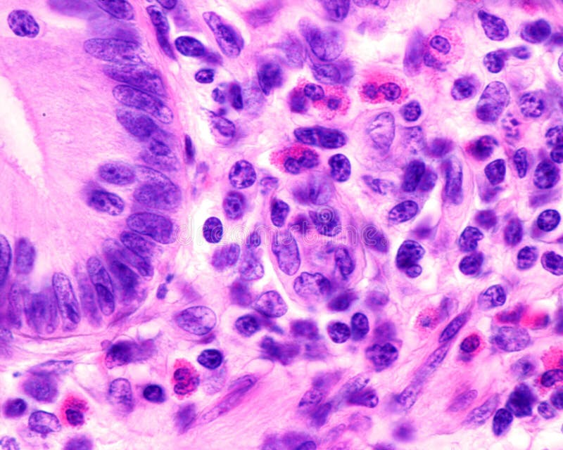 Human Appendix. Eosinophils Stock Illustration - Illustration of ...