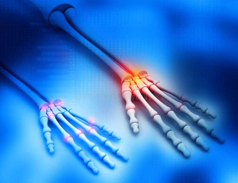 Arm Bones Stock Illustrations – 3,839 Arm Bones Stock Illustrations ...