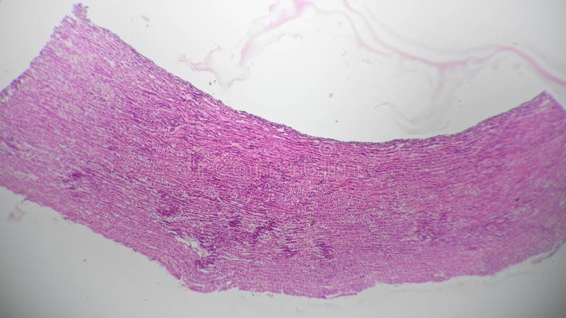 The Human Artery Section Observed Under Microscope 200x To Examine the ...