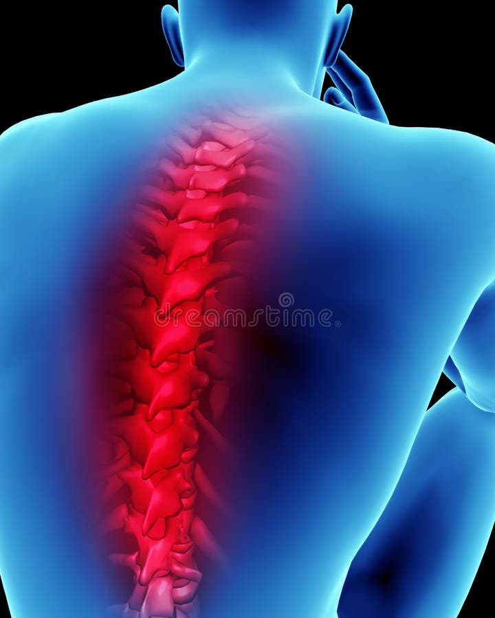Human Back Pain Medical Spinal Cord Skeleton Stock Illustration ...