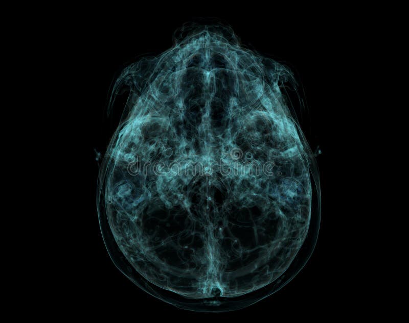 Human Skull, Brain by CT Scan. X-ray Visualization Inside of Skull. 3D ...