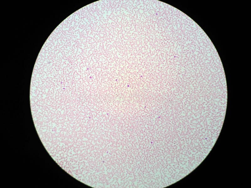 Human blood cells stock photo. Image of cancer, micro - 89484392