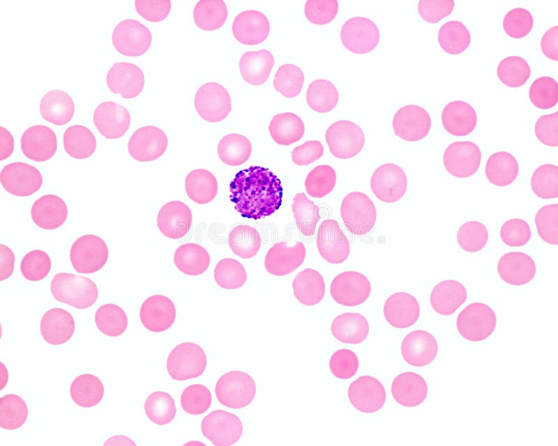 Human Blood Smear. Basophil Stock Image - Image of eosinophil ...