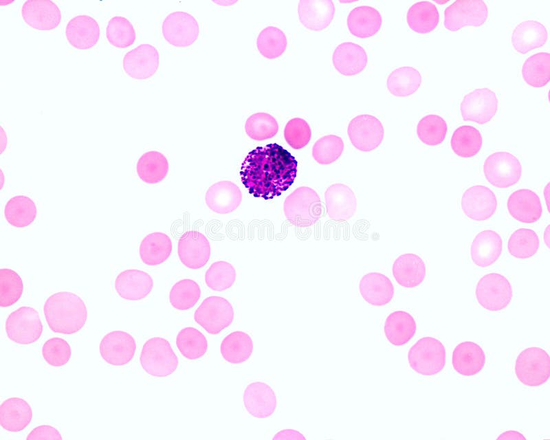 Human Blood Smear. Basophil Stock Image - Image of basophil, microscopy ...