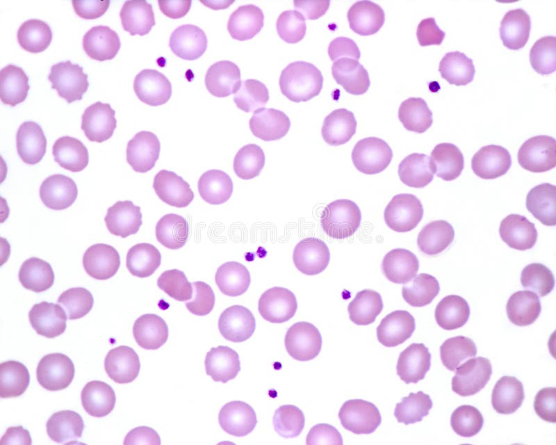 Human Blood Smear. Platelets Stock Image - Image of histology ...