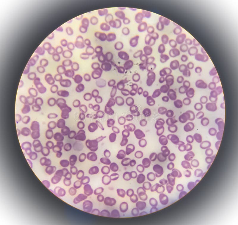 Human Blood Smear Under Microscope IMG_2894 | Human Blood Smear 400x,