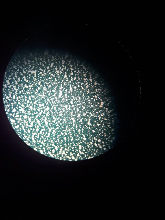 Human Body Blood Cells Under Microscope Stock Illustration ...