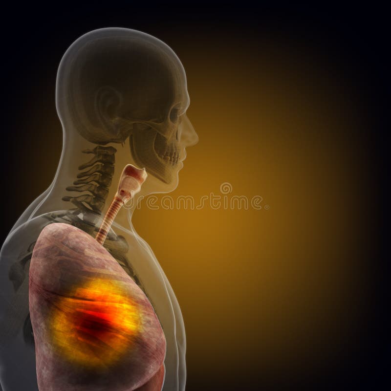 The Human Body (organs) by X-rays on Black Background Stock ...