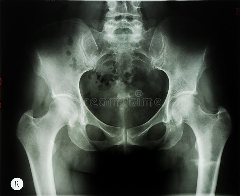 Human body s radiograph stock image. Image of film, radiation - 10316877
