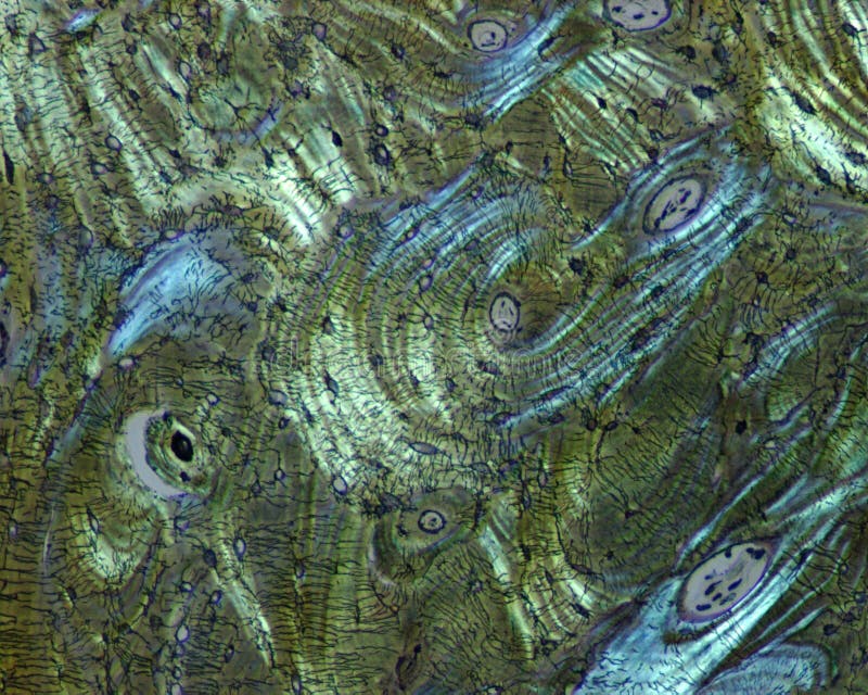 Bone Cells Under A Microscope