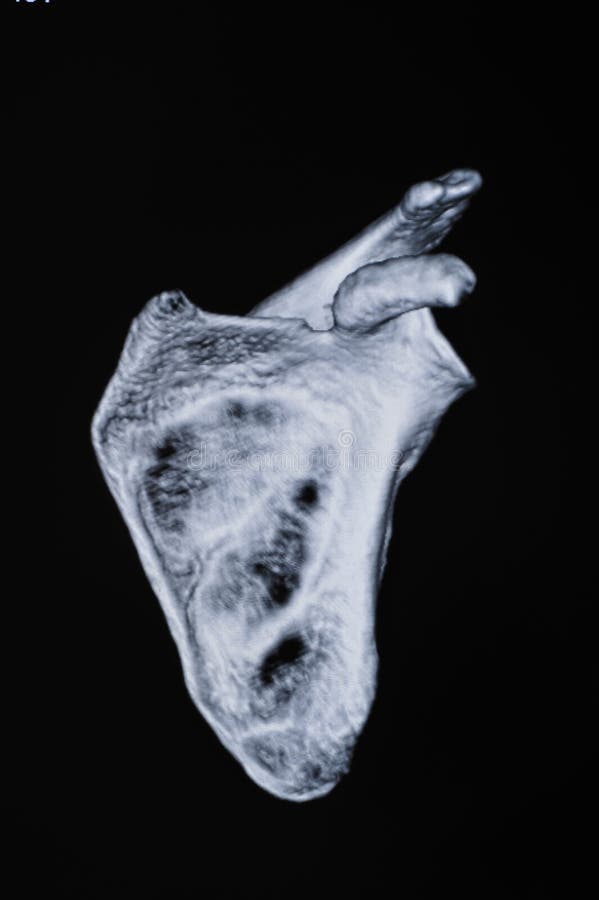 Human bone CT images stock illustration. Illustration of technology ...