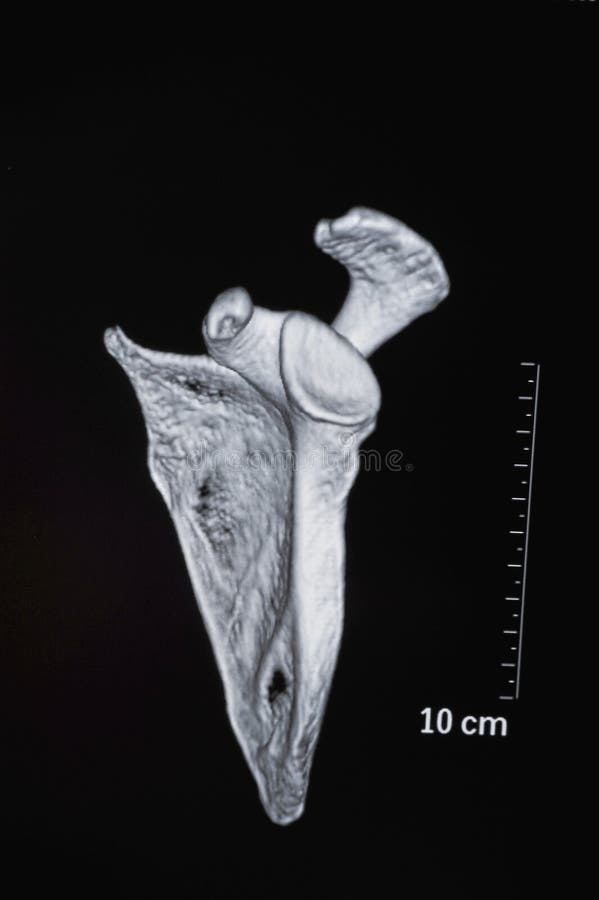 Human bone CT images stock illustration. Illustration of patient ...