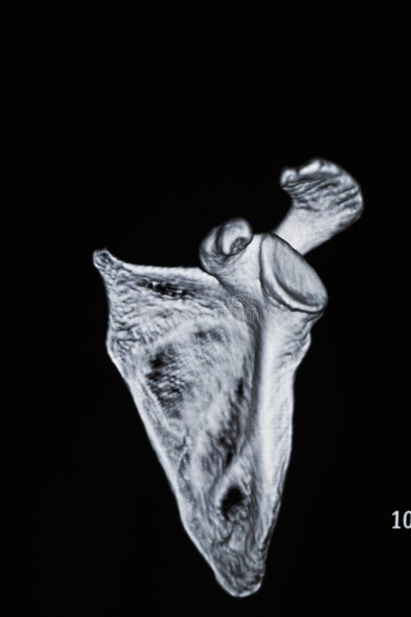 Human bone CT images stock illustration. Illustration of radiology ...