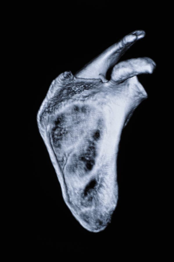 Human bone CT images stock photo. Image of cord, medical - 353891956