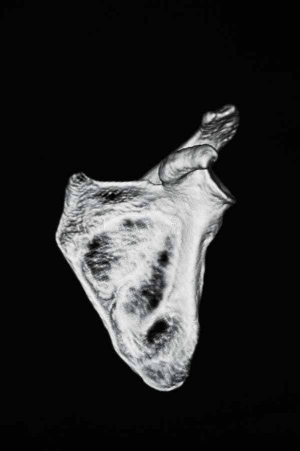 Human bone CT images stock illustration. Illustration of spine - 353892027