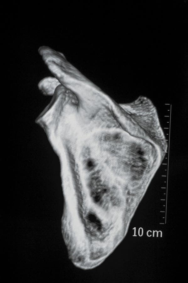Human bone CT images stock illustration. Illustration of columns ...