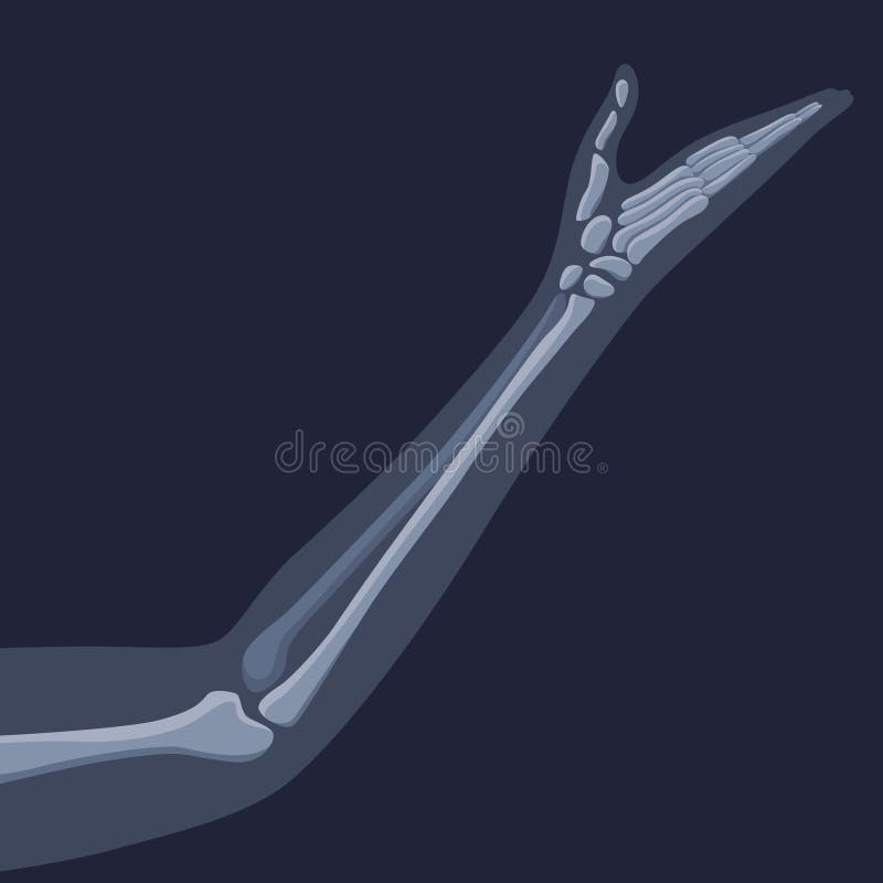 Human Bones Orthopedic and Skeleton Icon, Bone X-ray Image of Human ...