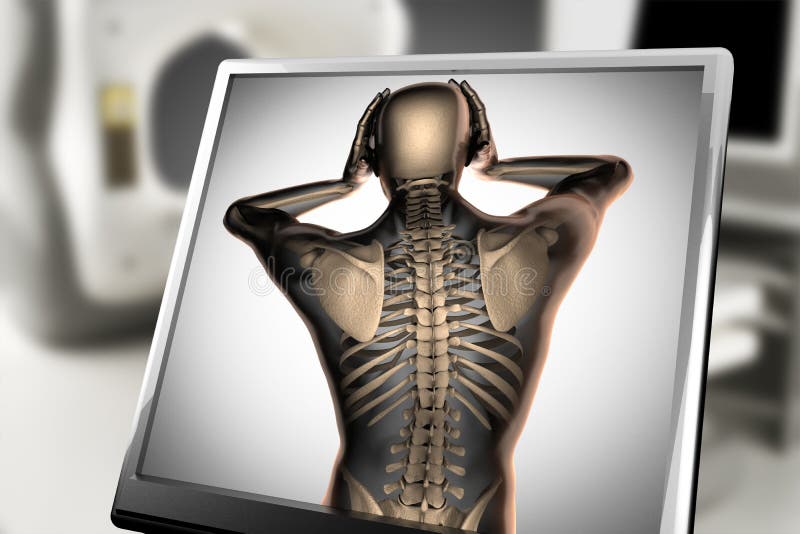 Human Bones Radiography Scan Image Stock Image - Image of adult ...