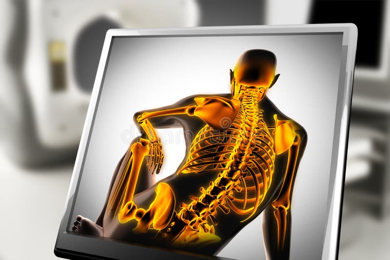 Human Bones Radiography Scan Image Stock Image - Image of backbone ...