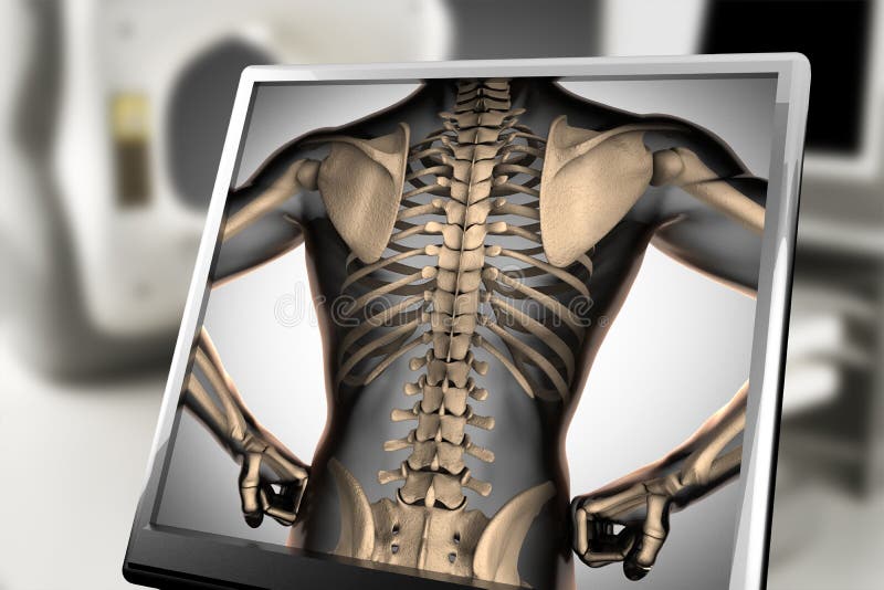 Human Bones Radiography Scan Image Stock Image - Image of medical ...
