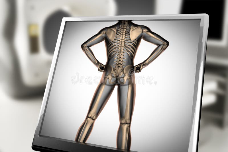 Human Bones Radiography Scan Image Stock Photo - Image of bones ...