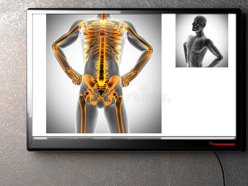 Human Bones Radiography Scan Image Stock Image - Image of examination ...
