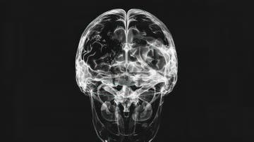 Human Brain in a Ct Scan Created with Generative AI. Scanning with X ...