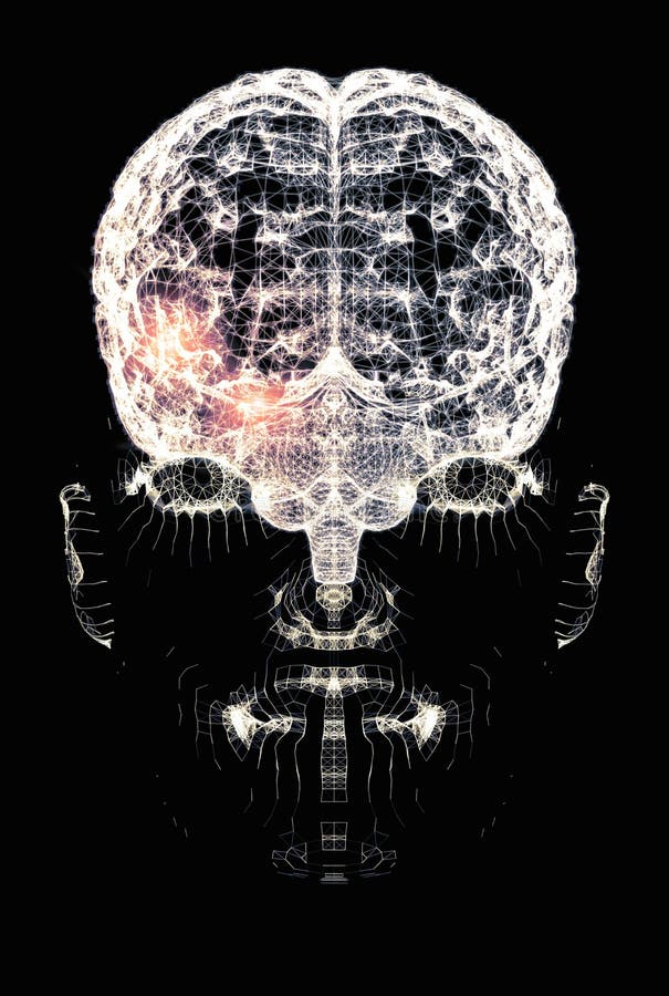 Human Brain and Face Viewed from the Front. X-rays, Particles Stock ...