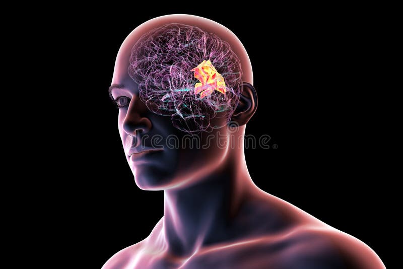 Human Brain with Highlighted Precuneus Gyrus, 3D Illustration Stock ...