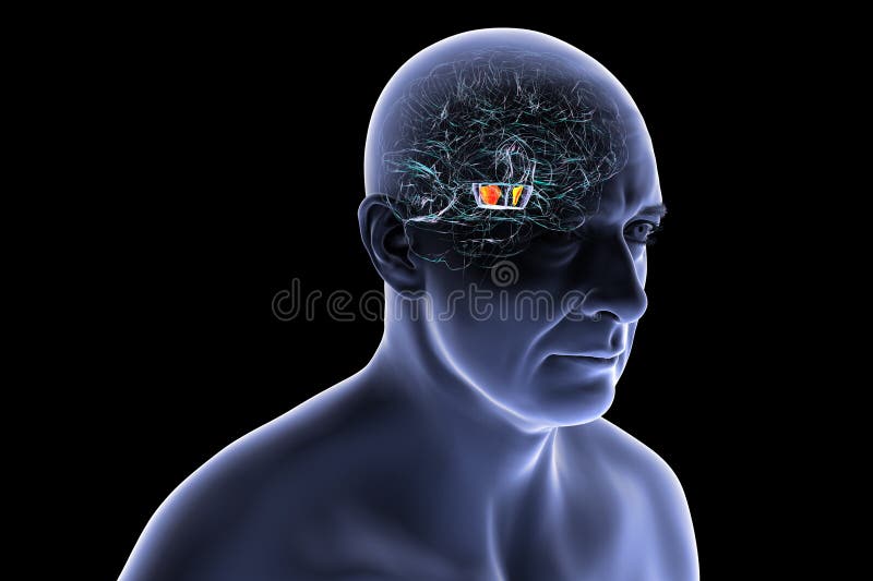 Parkinson Movement Stock Illustrations – 340 Parkinson Movement Stock ...
